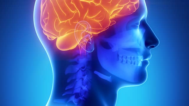 Gevolgen herseninfarct heftiger dan gedacht | NU - Het laatste nieuws ...